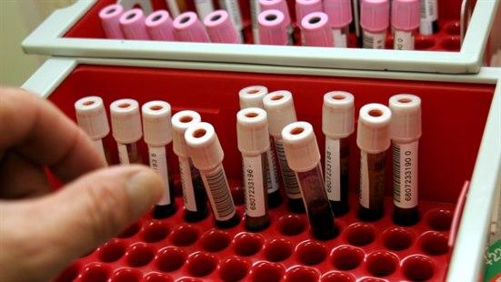 Blodkreft: Akutt myelogen leukemi - NHI.no