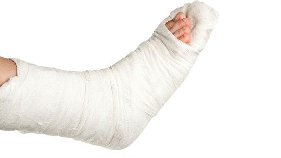 Gips versus funksjonell ortose ved ikke-kirurgisk behandling av ...