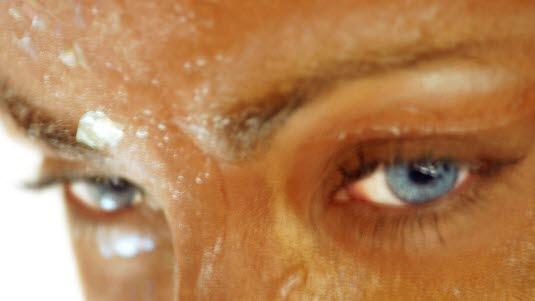 Anhidrose, nedsatt evne til å svette - NHI.no