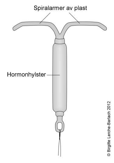 Hormonspiral - NHI.no
