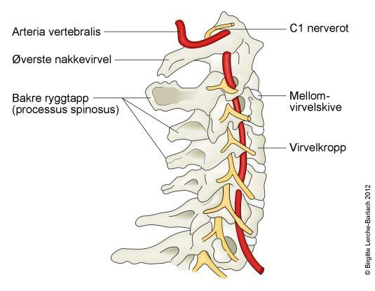 Nakkeprolaps - NHI.no