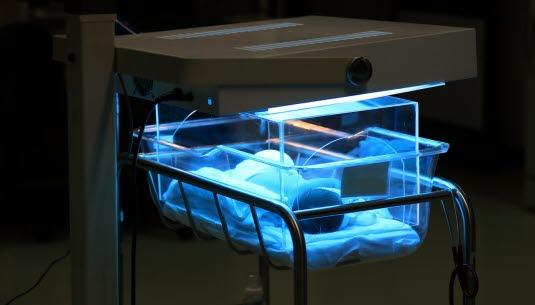 Gulsott hos nyfødte - NHI.no