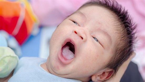 Soppinfeksjon i munnen - NHI.no